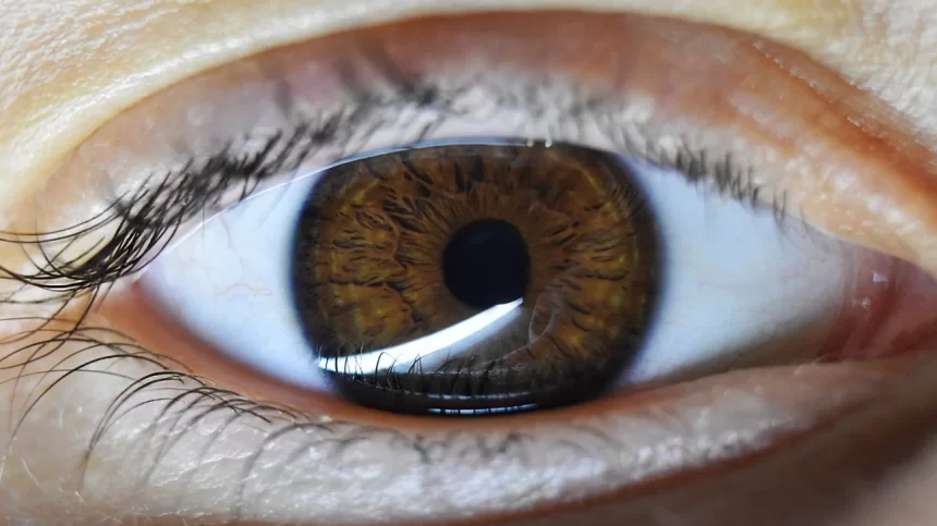 Comparing Contact Lenses: With and Without Limbal Ring Features - Vents ...